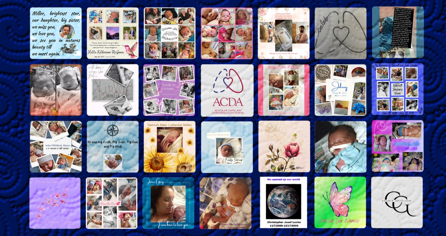 ACD Association | Alveolar Capillary Dysplasia